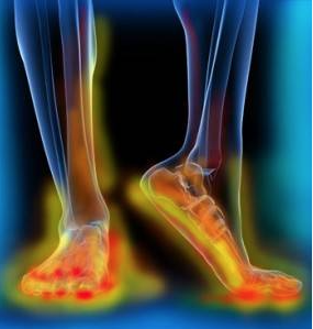 What is Neuropathy - Neuropathy Relief Project